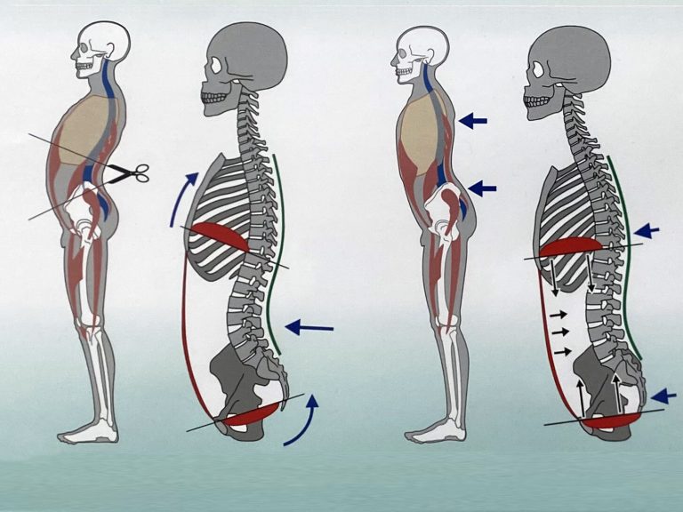 How Proper Breathing Supports Good Posture (and Why It Matters ...